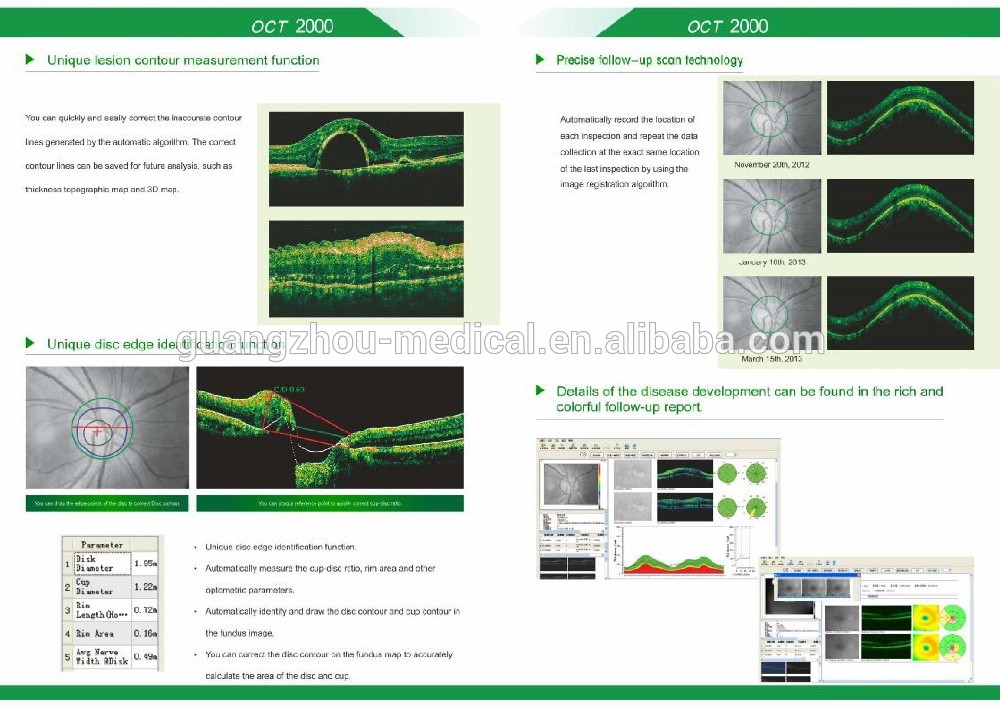 Professional Optical coherence tomography ophthalmic OCT manufacturers ...