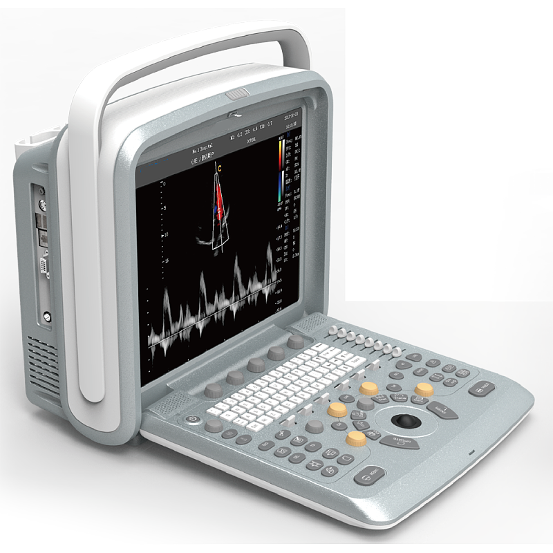 Professional Cardiac Echo Portable China Doppler Ultrasound Machine for ...